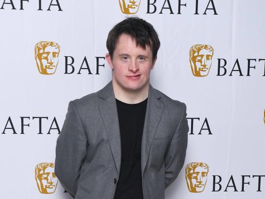 Line of Duty actor with Down's syndrome backs new Down's syndrome ...