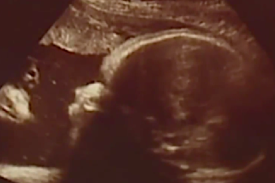 Couple says sonogram shows Jesus watching over their baby