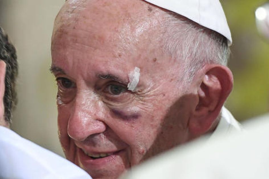 Pope gets black eye in Colombia
